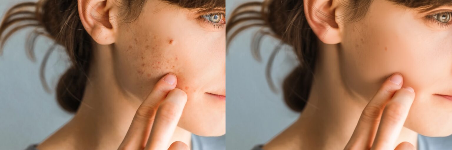 Face Enhancer: herramienta de mejora de retratos con IA